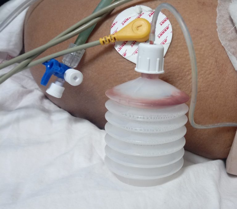 Surgical Drain Indication Uses Types Complication Surgical Technology 1264