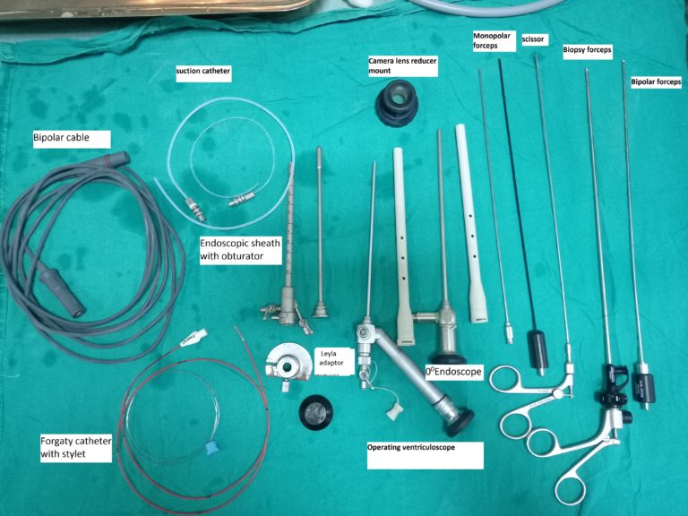 Endoscopic Third Ventriculostomy Procedure